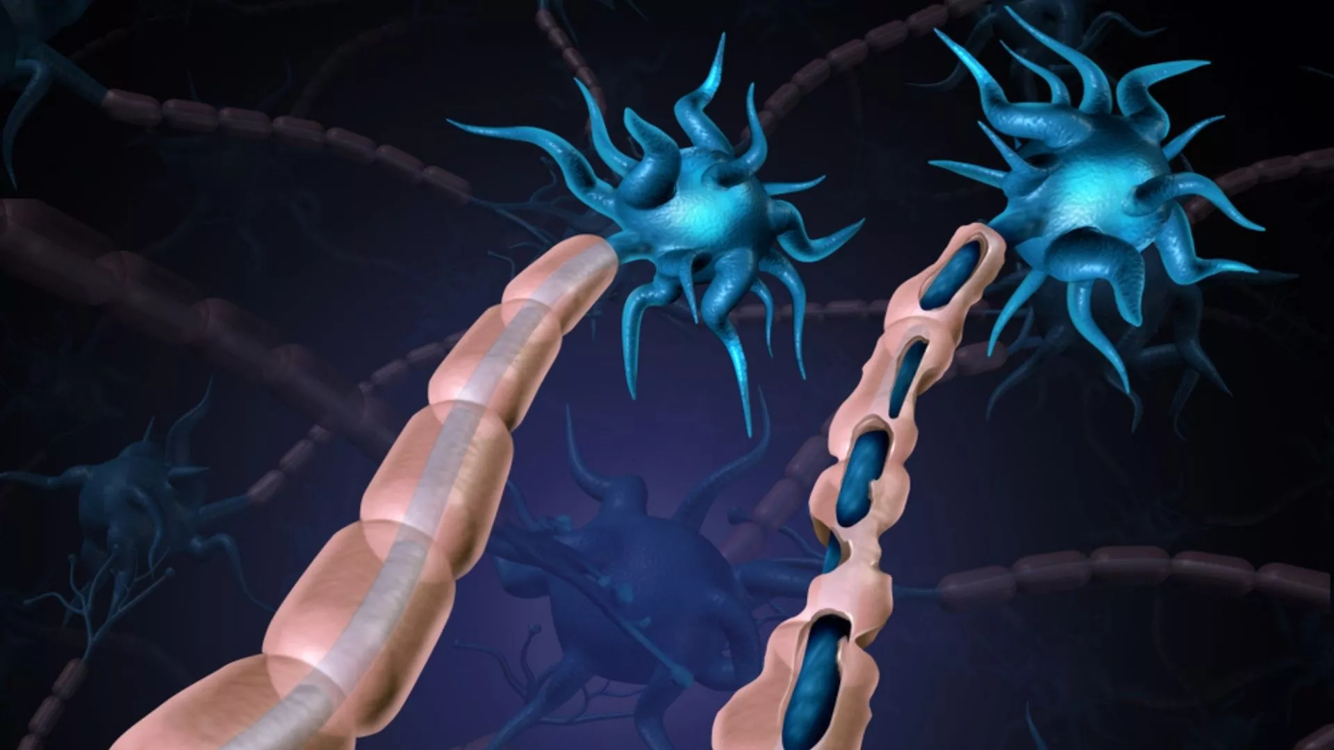 Peripheral Nerve Injury | Saebo UK