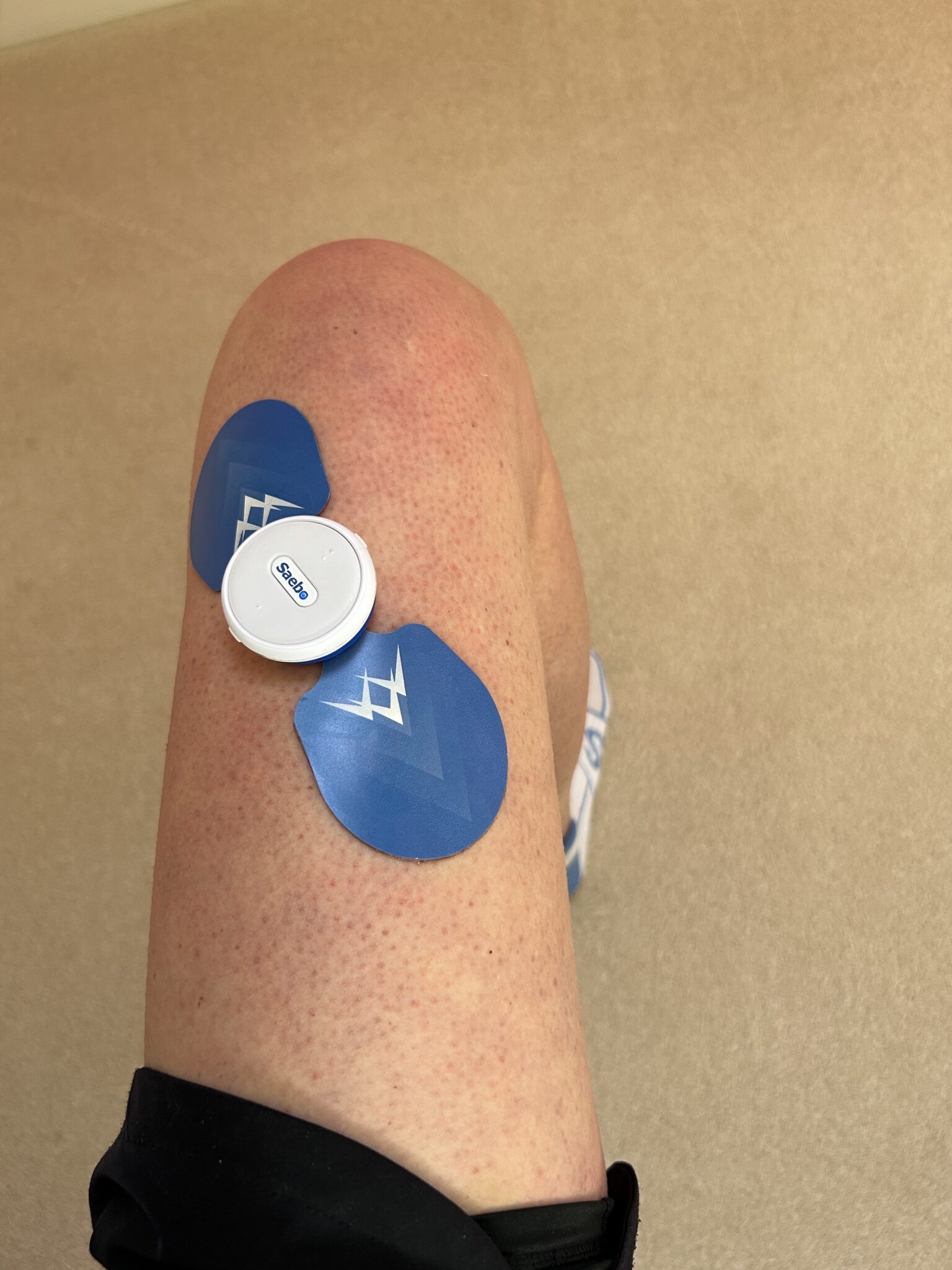 How NMES Can Help Relieve Arthritis Symptoms and Improve Mobility ...